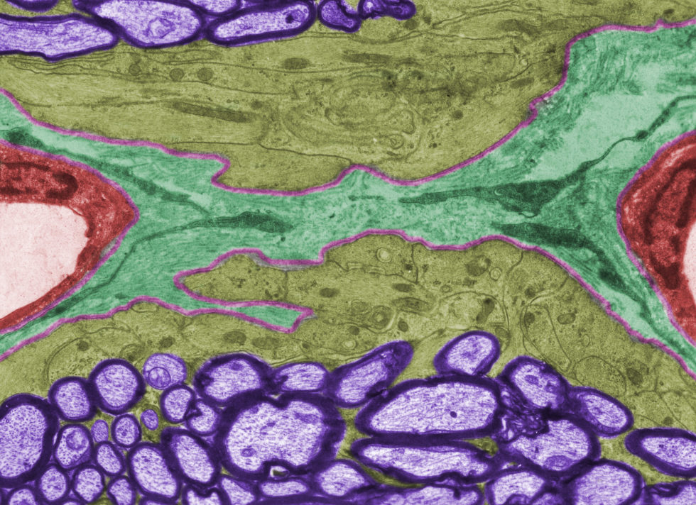 How Your Brain Eats Itself – To Improve Memory | leading brains Review